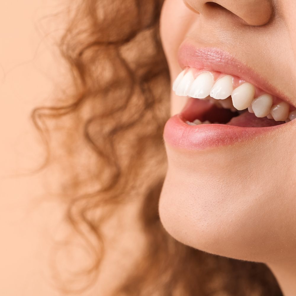 Dents parfaites : Comment avoir de belles dent ? – So Bleam